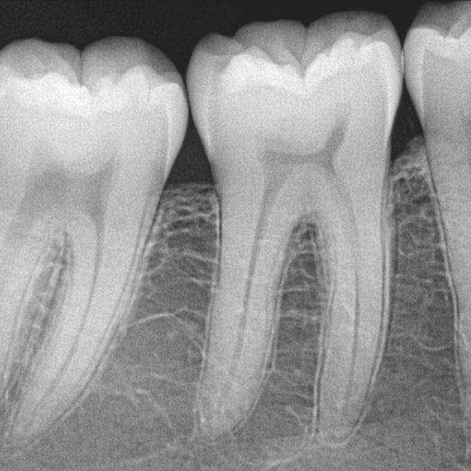 Sensor radiovisiógrafo | Xios XG Supreme - Representaciones Eurodent