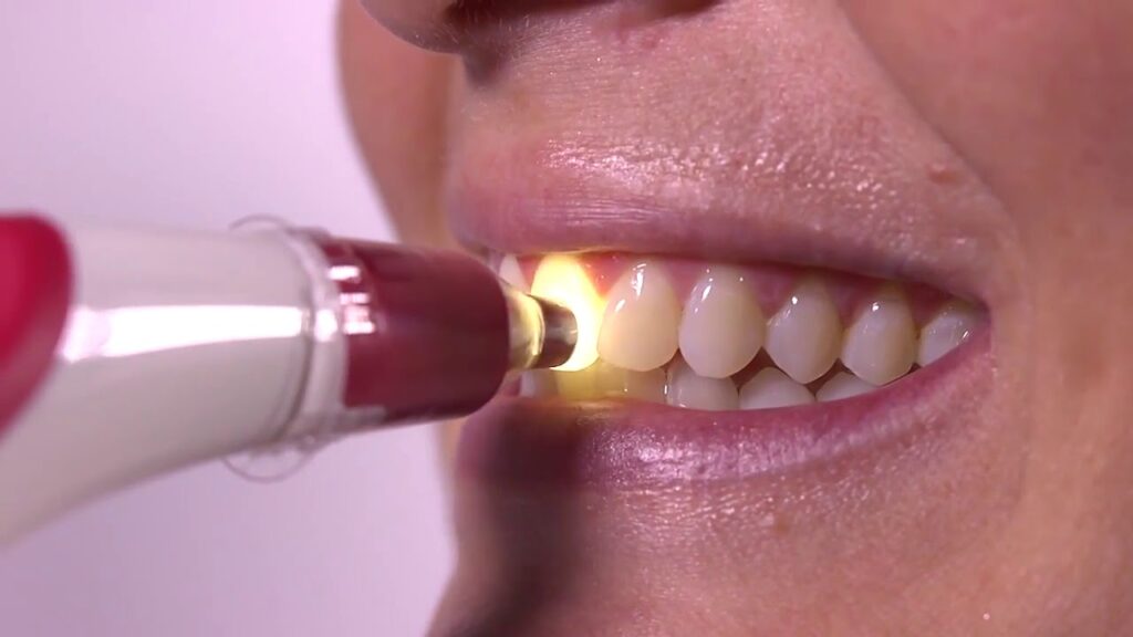 Equipo para toma de color | Easyshade V - Representaciones Eurodent